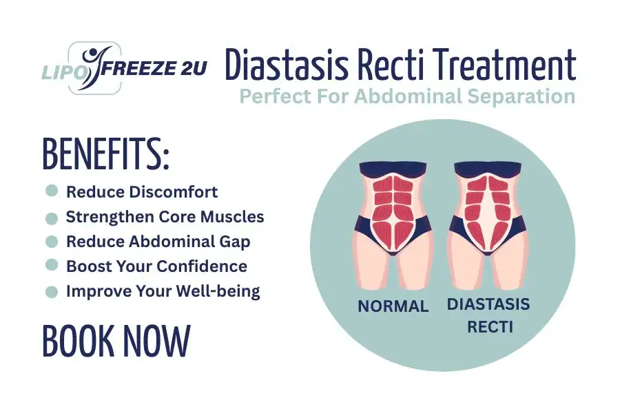 10 Benefits of Body Toning 4 Diastasis Recti Edinburgh